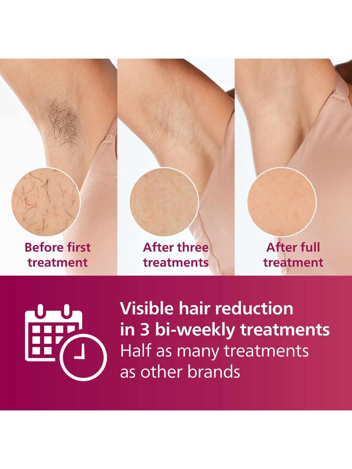 Philips Lumea 7000 Series, IPL Hair Removal Device, with Satin Compact ...